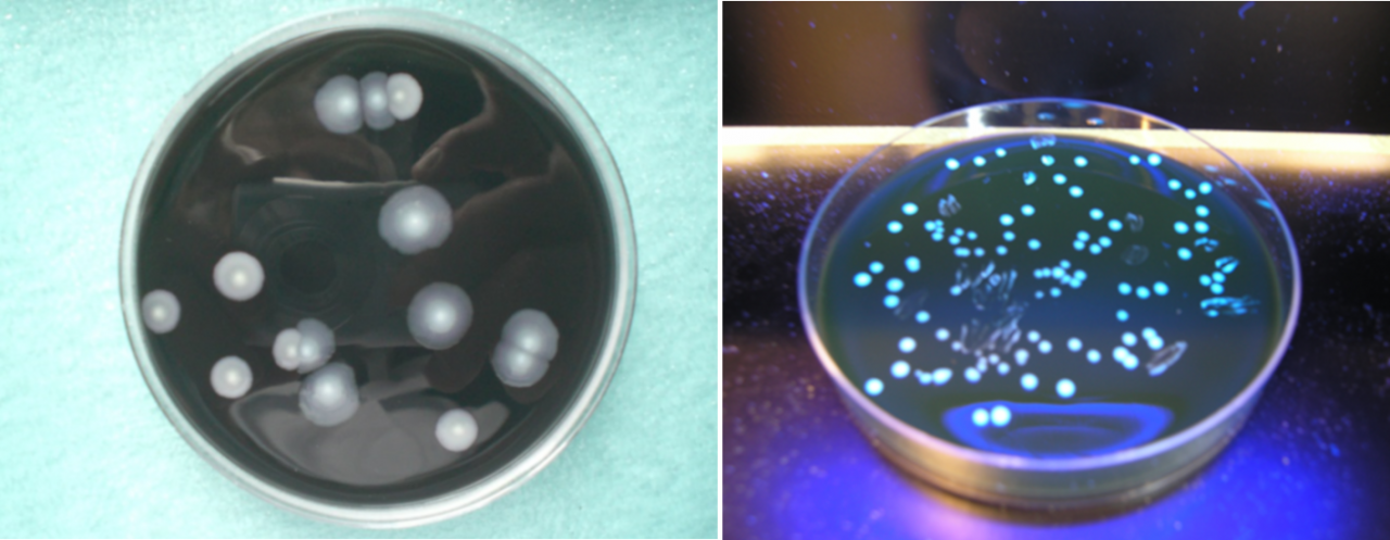 "The Philly Killer": Emergence of Legionella pneumophila, a ubiquitous ...