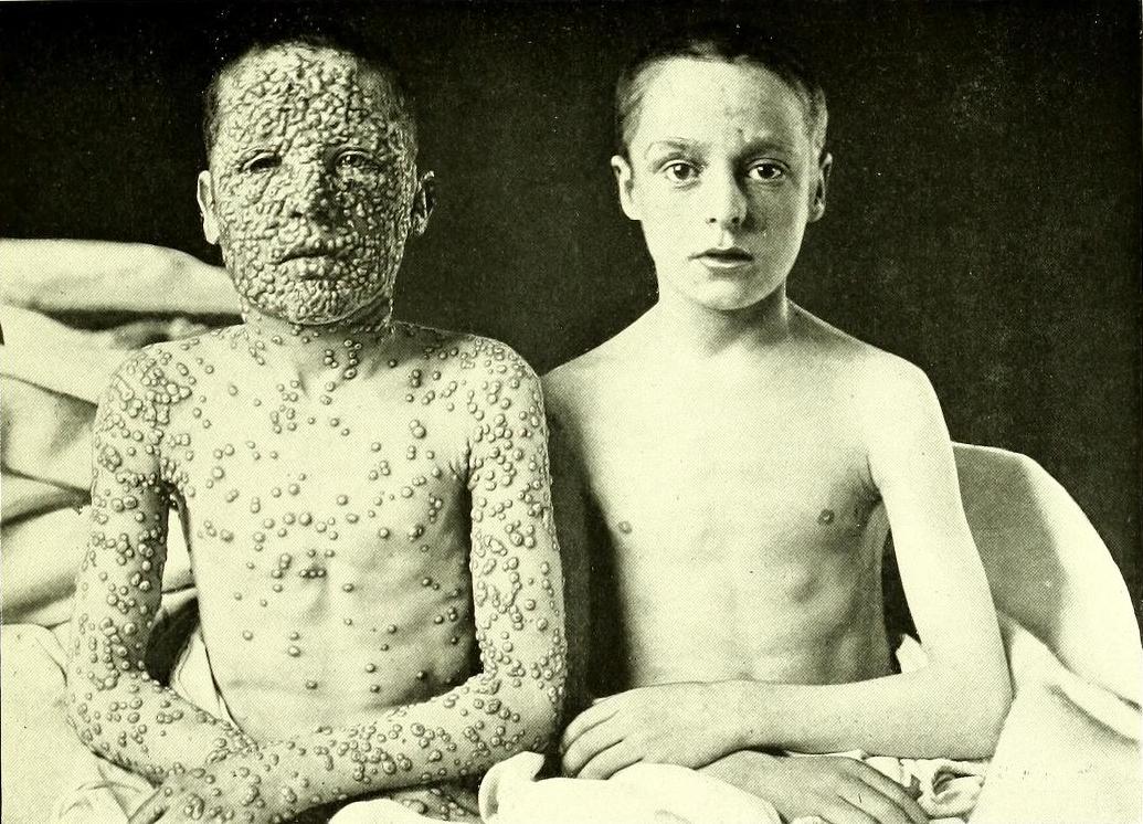 smallpox mutation